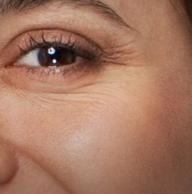 Personalised Prescription Anti-Ageing Treatments - Dermatica